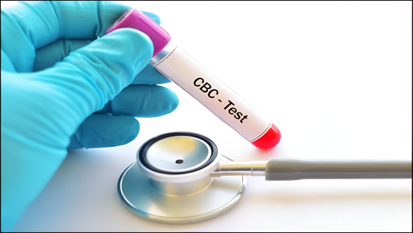 Can CBC Tests Help Detect Chronic Conditions Early? - Goodreturns